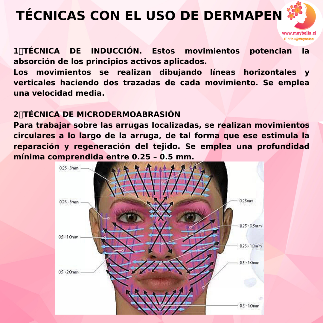 Dermapen - Técnicas de uso | Muybella.cl